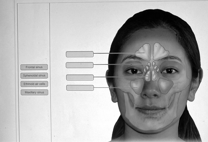 Frontal sinus Sphenoidal sinus Ethmoid air cells Maxillary sinus