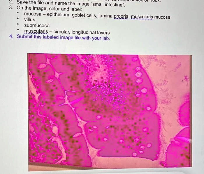 SOLVED: Texts: Label the histology of the small intestine. Save the ...