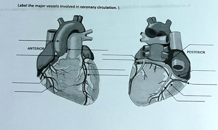 Label the major vessels involved in coronary circulation. ). Label the ...