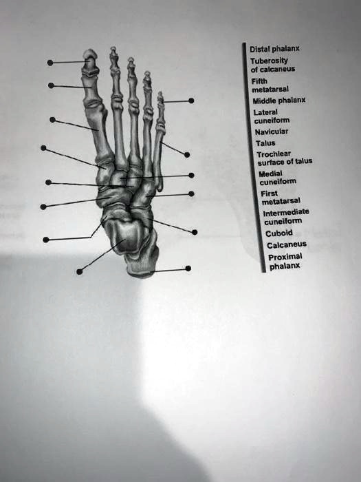Distal phalanx Tuberosity of calcaneus Fifth metatarsal Middle phalanx ...