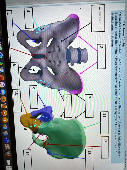SOLVED: Ischial spine, Sacrum, Ilium, Ischium, Pubis, Posterior ...