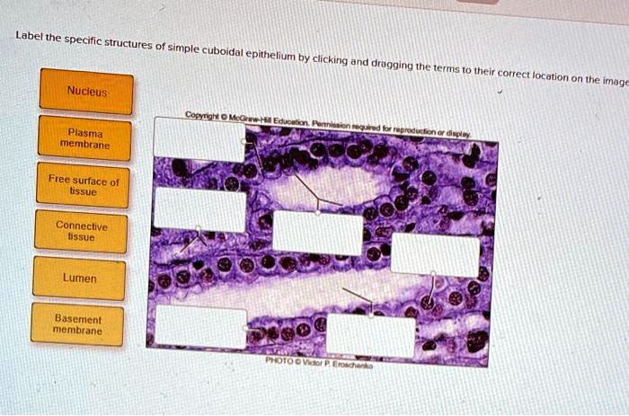 SOLVED: Label the specific structures of simple cuboidal epithelium by ...