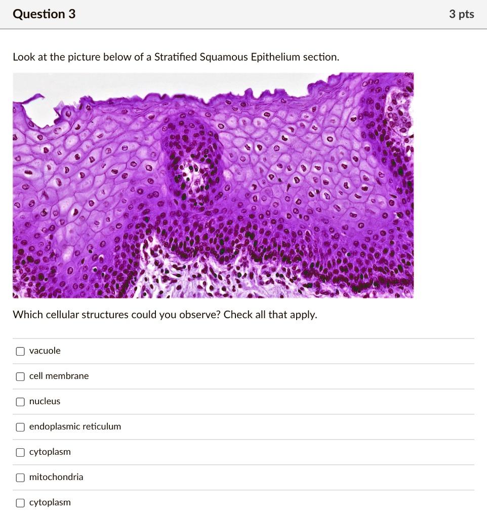 Question 3 3 pts Look at the picture below of a Stratified Squamous ...