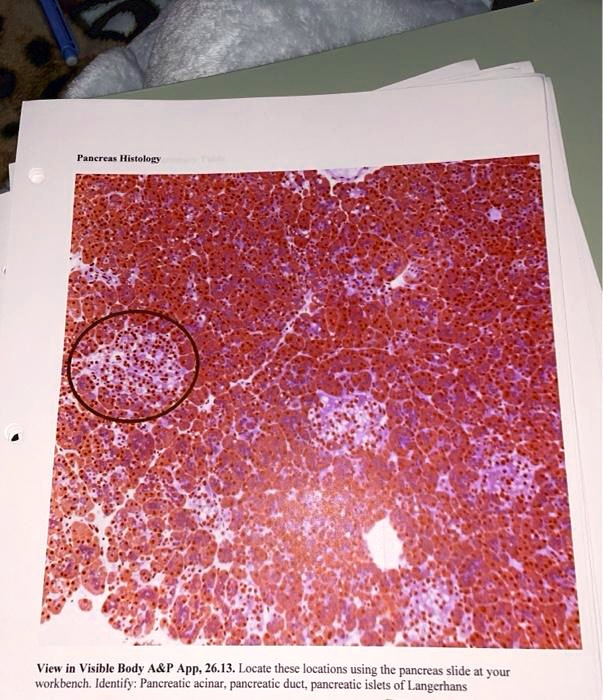 SOLVED: Pancreas Histology View in Visible Body AP App, 26.13. Locate ...