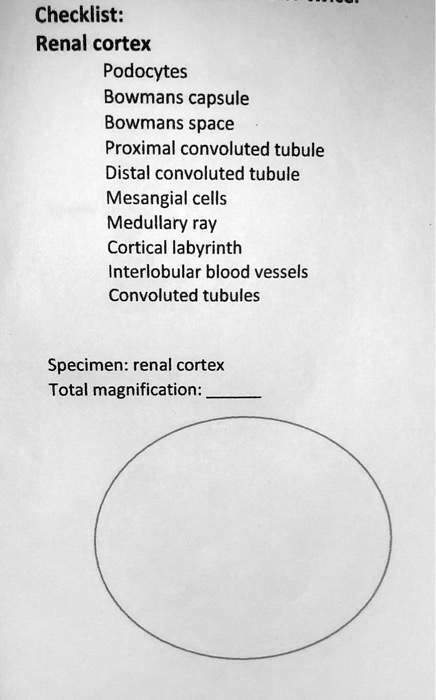Checklist: Renal cortex Podocytes Bowmans capsule Bowmans space ...