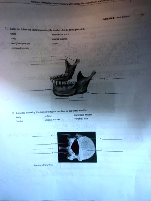 SOLVED: 23 angle body condylar process coronoid process mandibular ...