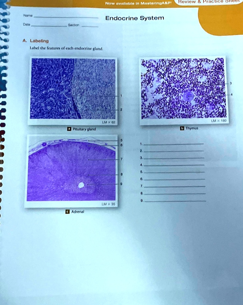 SOLVED: Now available in Mastering A P: Review Name Endocrine System A ...