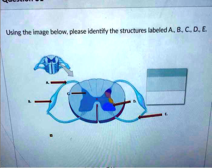 SOLVED: Using the image below, please identify the structures labeled A, B, C, D, and E.