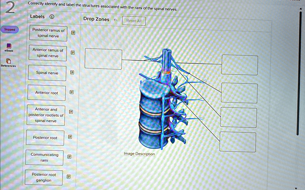 correctly identify and label the structures associated with the rami of ...