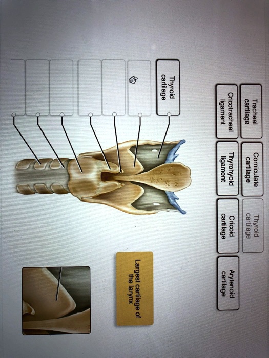 SOLVED: correctly label the features of the larynx. cartilage Thyroid ...
