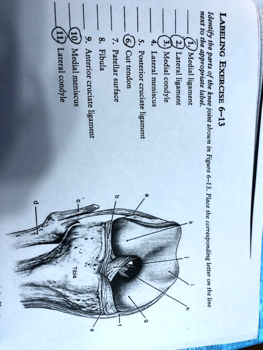 LABELING EXERCISE 6-13 Identify the parts of the knee joint shown in ...