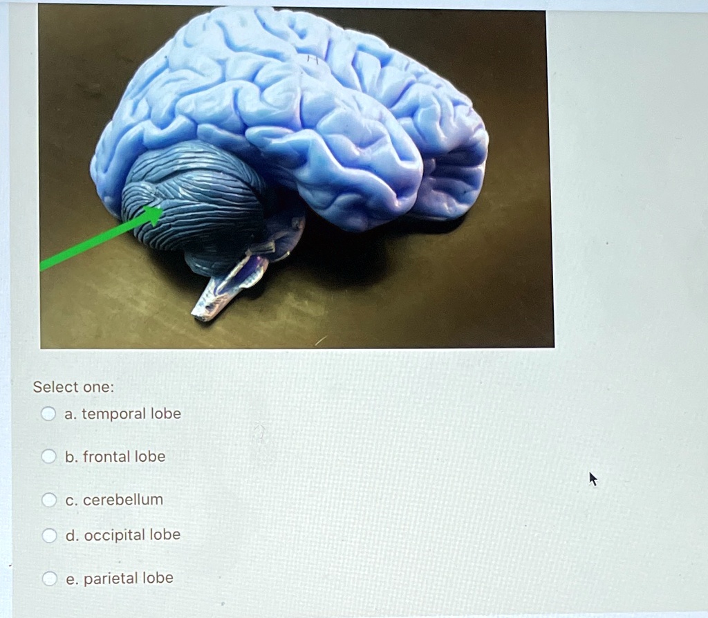 SOLVED: 'Select one: temporal lobe b. frontal lobe cerebellum d ...