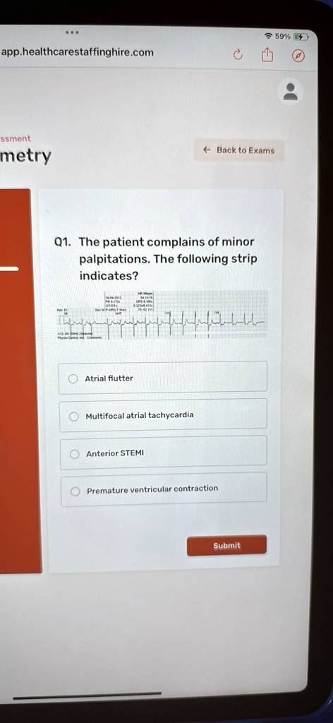 q1 the patient complains of minor palpitations the following strip ...