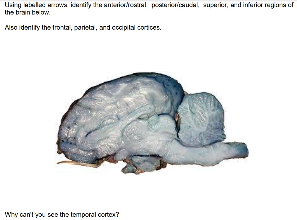 Using labelled arrows, identify the anterior/rostral, posterior/caudal ...