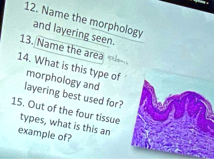 SOLVED: 12, Name the and layering morphology 13. IName seen: the 14 ...