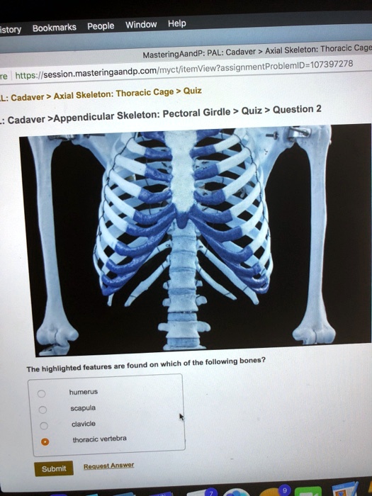 SOLVED: Lab Bookmarks People Window Help History MasteringAandP: PAL: Cadaver > Axial Skeleton ...