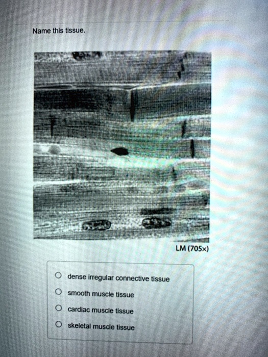 Dense Regular Connective Tissue Vs Smooth Muscle