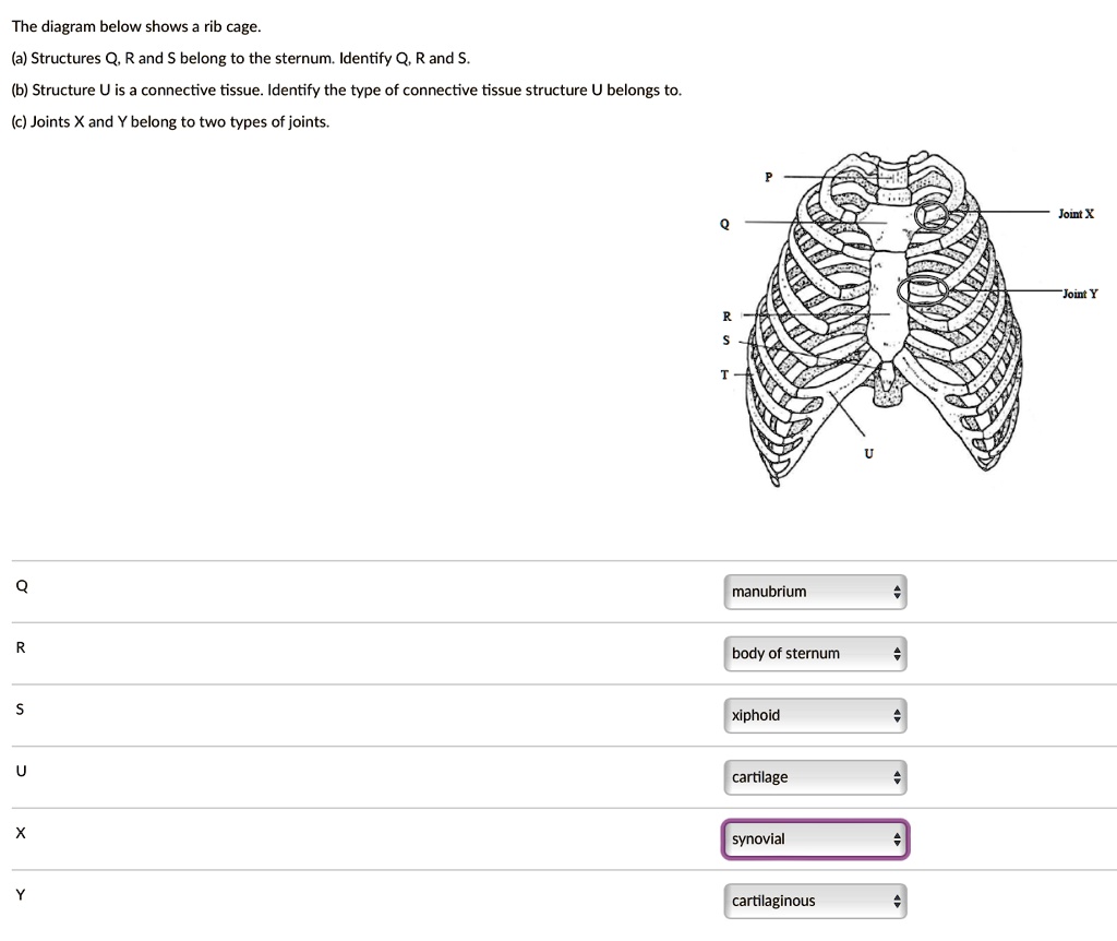 Could you please verify if my labeling of this diagram is correct? The ...