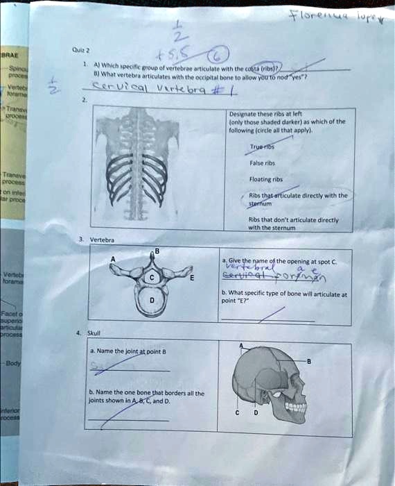 SOLVED: Texts: BRAE Spinous process Vertebrae foramen Transverse ...