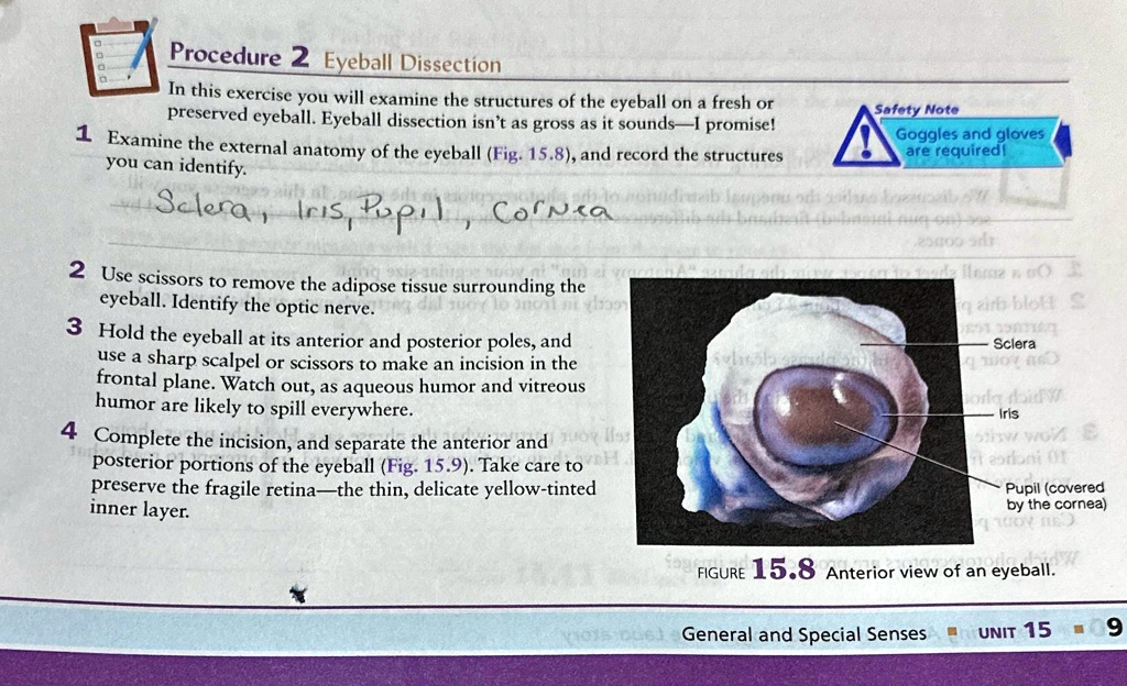 SOLVED: Procedure 2: Eyeball Dissection In this exercise, you will ...