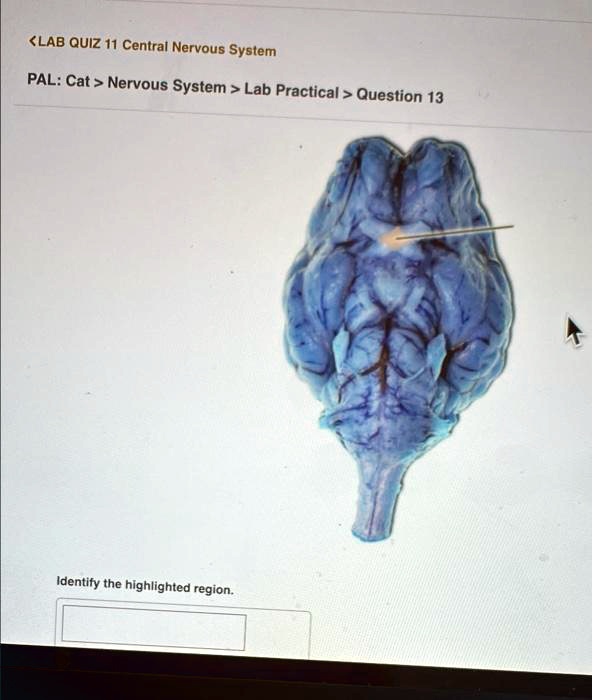 SOLVED: Nervous System>Lab Practical>Question 13 Identify the highlighted region.