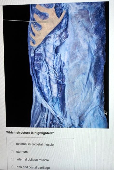SOLVED: Which structure is highlighted? external intercostal muscle ...