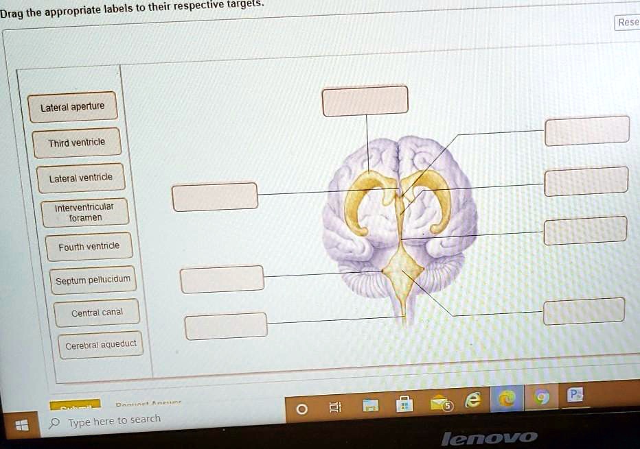 SOLVED: Drag the appropriate labels to their respective targets. Rese Lateral aperture Third ...