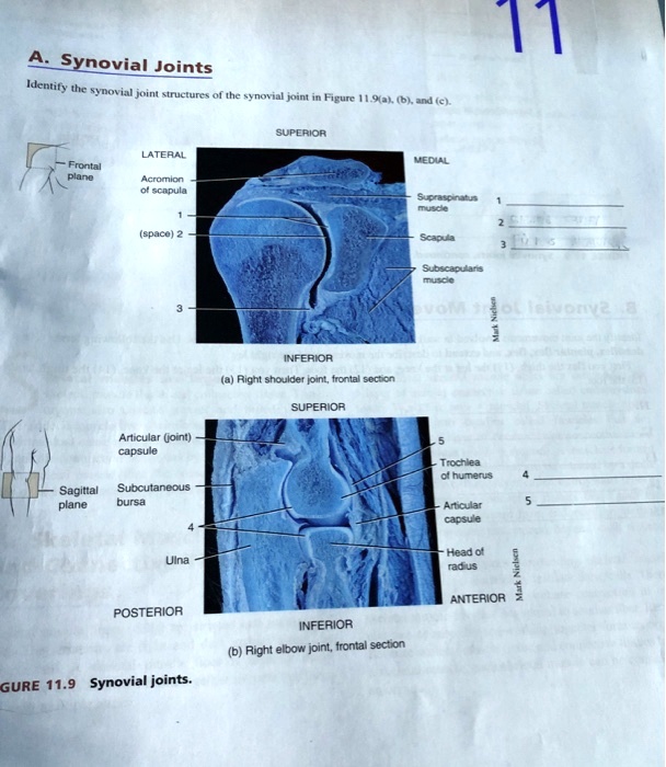 SOLVED: A. Synovial Joints SUPERIOR LATERAL Frontal plane MEDIAL ...