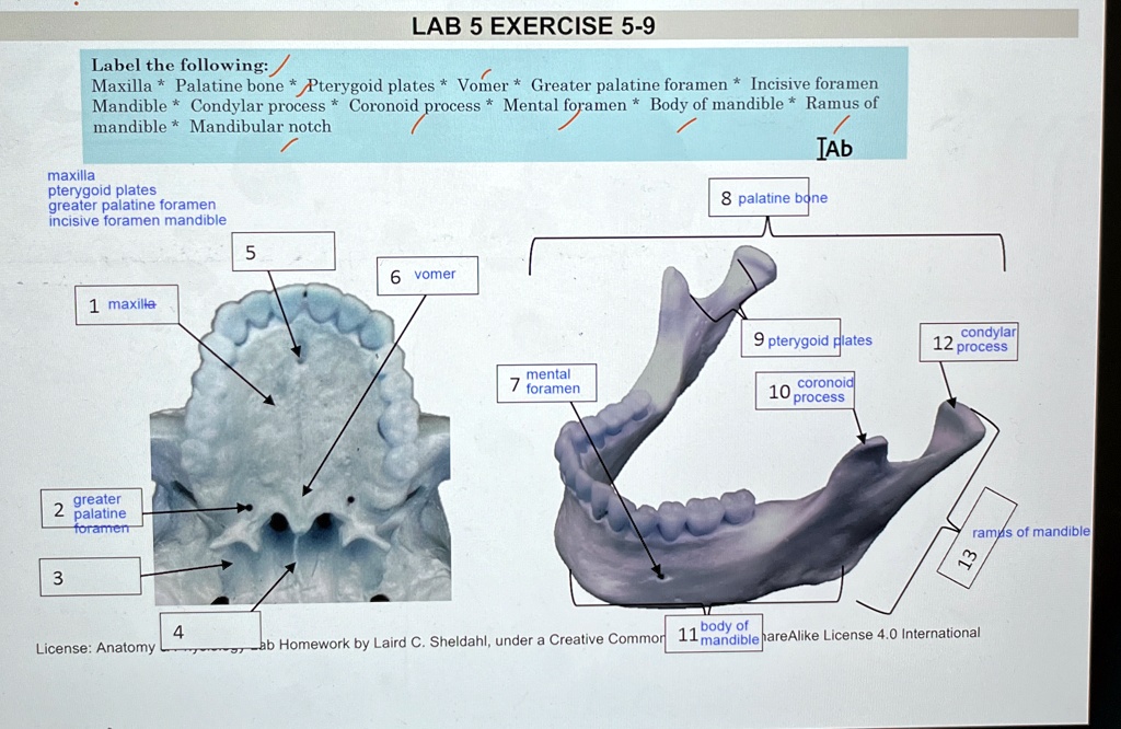 LAB 5 EXERCISE 5-9 Label the following: Maxilla * Palatine bone ...