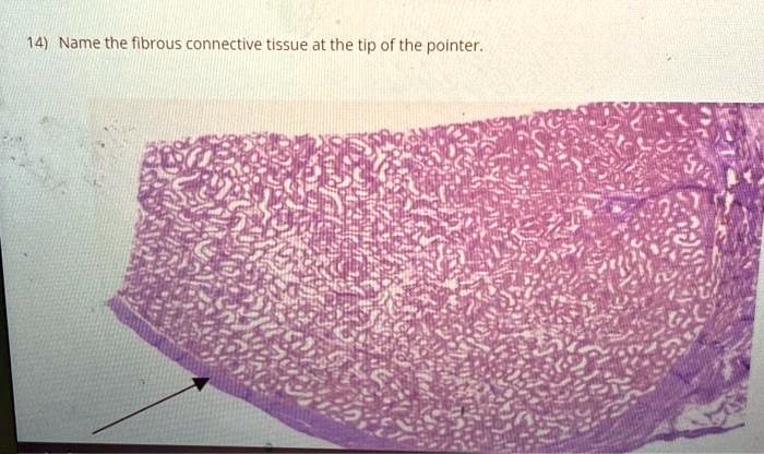 14 name the fibrous connective tissue at the tip of the pointer 85664