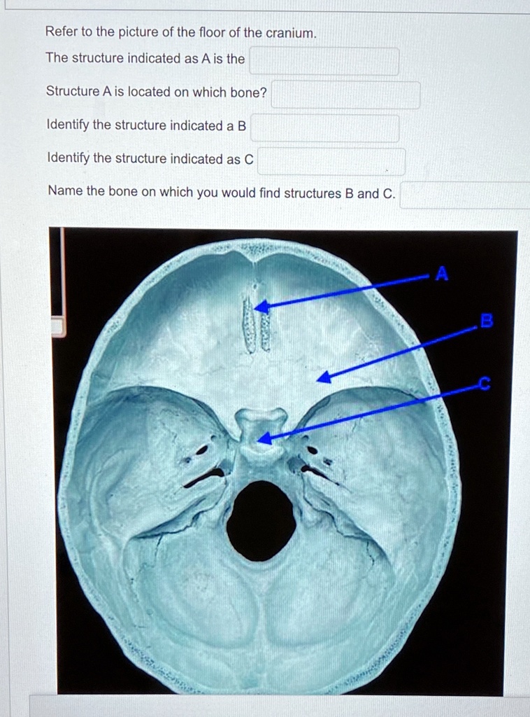 SOLVED: 'Refer to the picture of the floor of the cranium The structure indicated as A is the ...