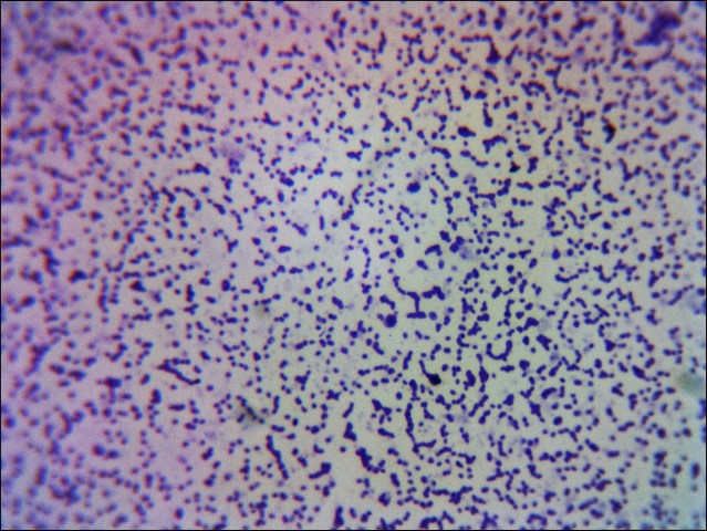 Using the field of view calculated for the high power lens, what is the ...