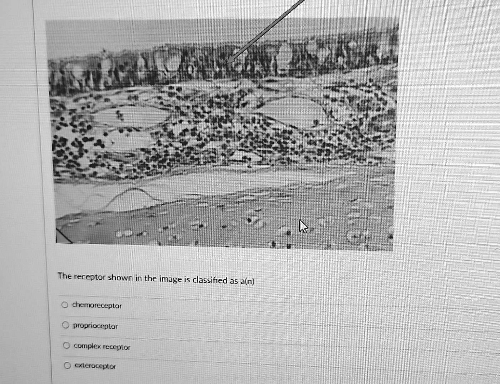 The receptor shown in the image is classified as a(n) O chemoreceptor O ...