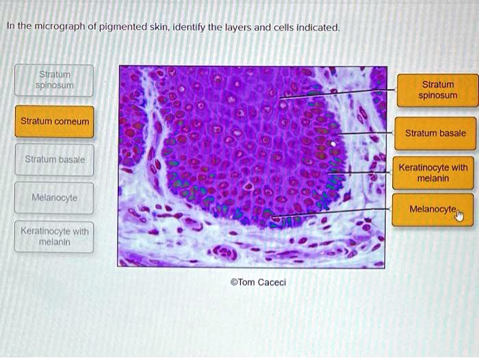in the micrograph of pigmented skinidentify the layers and cells indicated stratum spinosun ...
