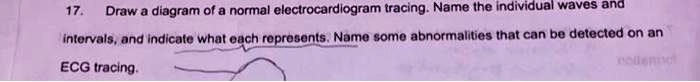 SOLVED: 17. Draw a diagram of a normal electrocardiogram tracing. Name the individual waves and ...