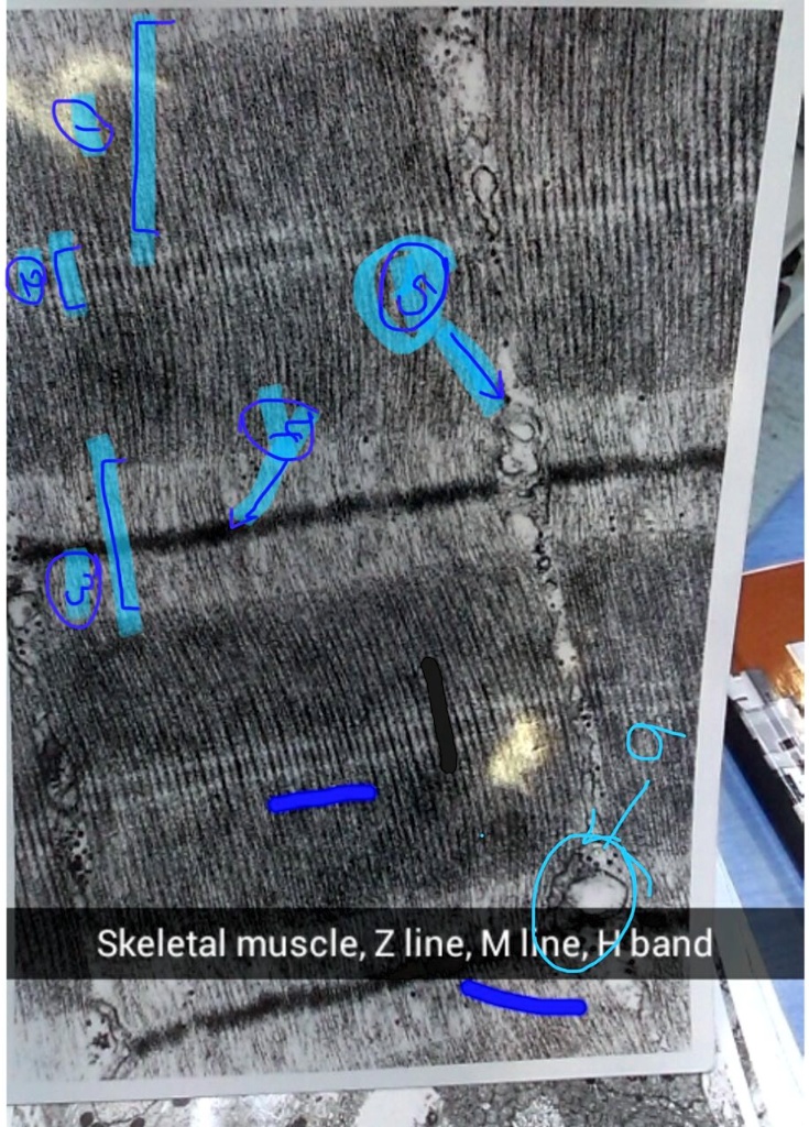 SOLVED: Skeletal muscle; Z line, M Ilne,Wband