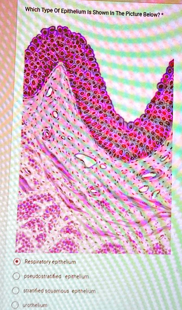 Which Type Of Epithelium Is Shown In The Picture Below? * Respiratory ...