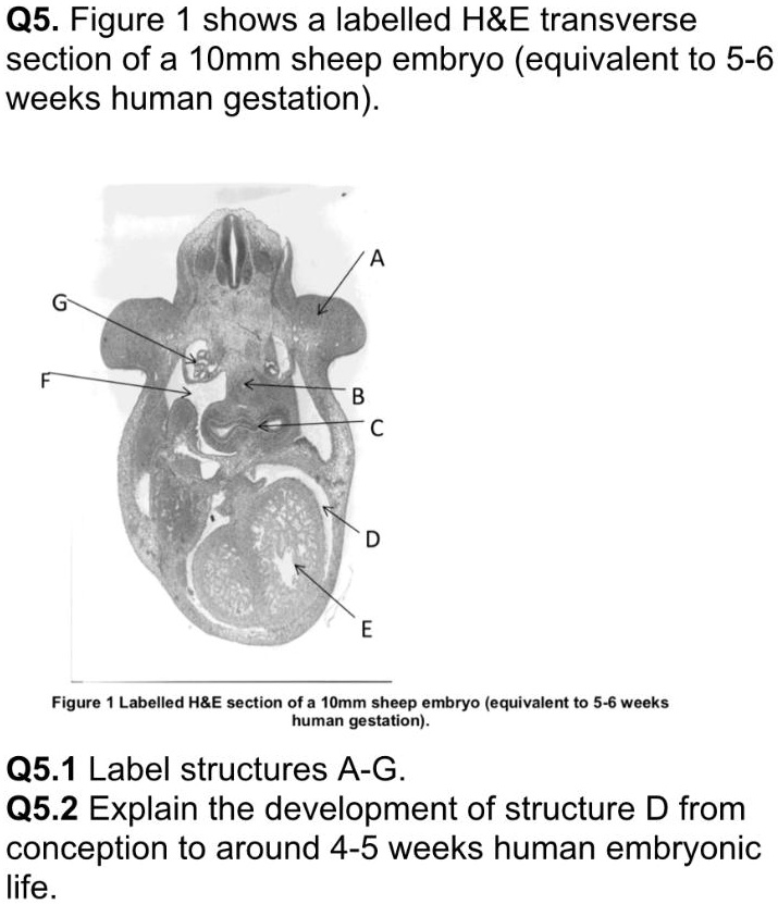 SOLVED: Q5. Figure shows a labelled H E transverse section of a 10mm ...