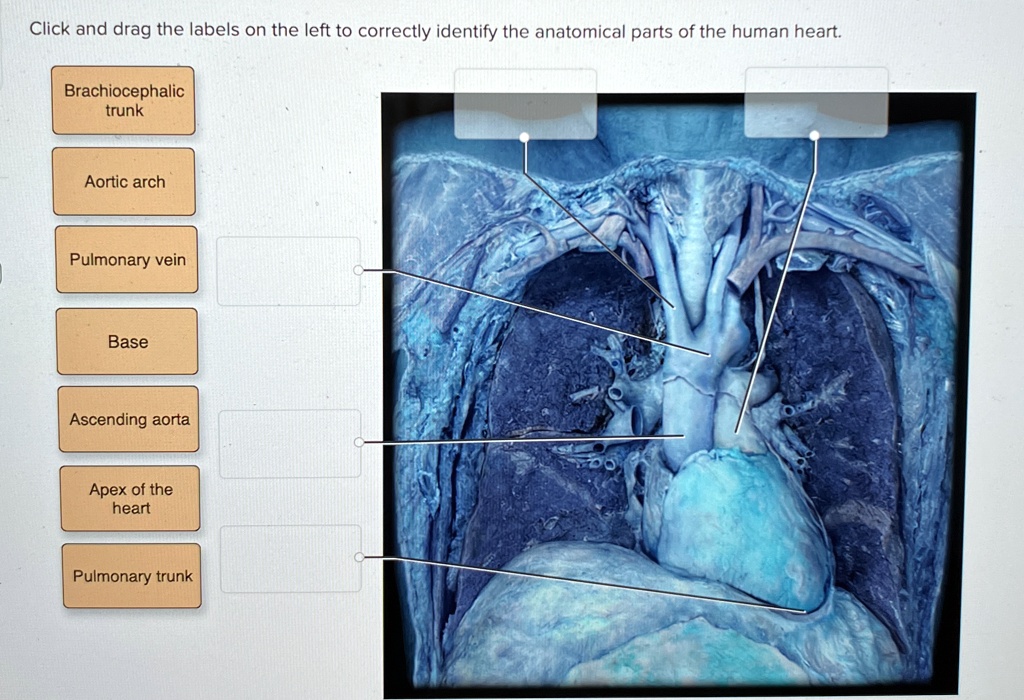 Click and drag the labels on the left to correctly identify the ...