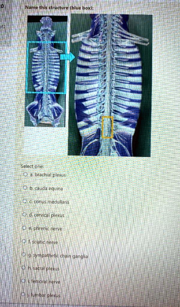 0 Name this structure (blue box): Select one: a. brachial plexus b ...