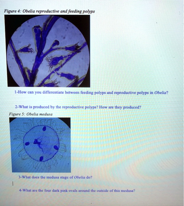 figure 4 obelia reproductive and feeding polyps how can you ...