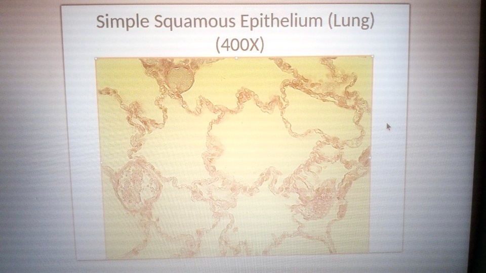 SOLVED: Simple Squamous Epithelium (Lung) (4oox)