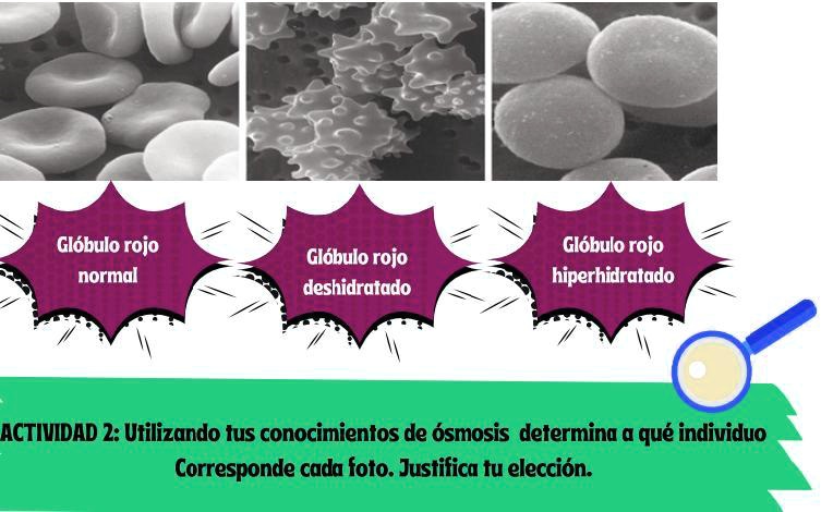 SOLVED: ayudenme con esto porfavor Glóbulo rojo normal Glóbulo rojo ...