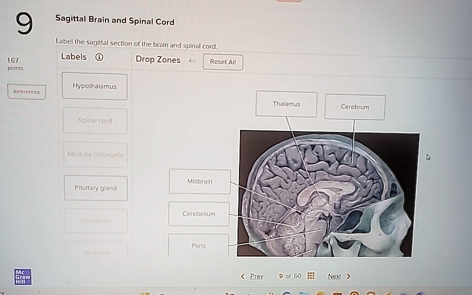 Sagittal Brain and Spinal Cord Label the sagittal section of the brain and spinal cord. 167 ...