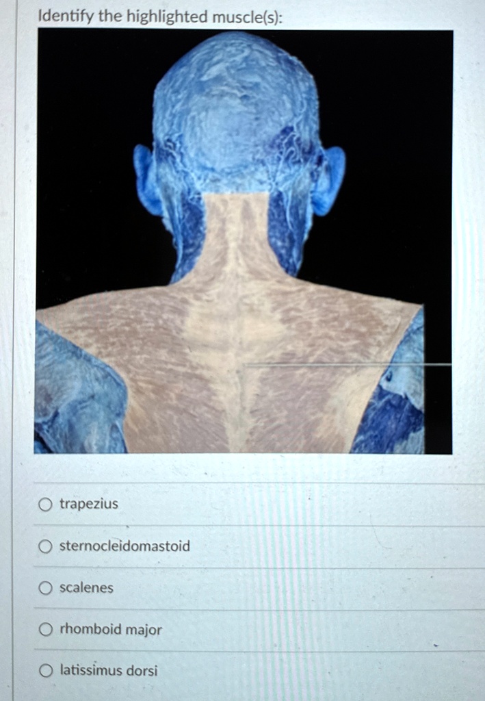 identify the highlighted muscles trapezius sternocleidomastoid scalenes ...