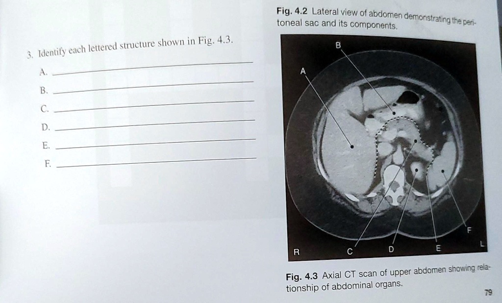 3. Identify each lettered structure shown in Fig. 4.3. A. B. C. D. E. F. Fig. 4.2 Lateral view ...