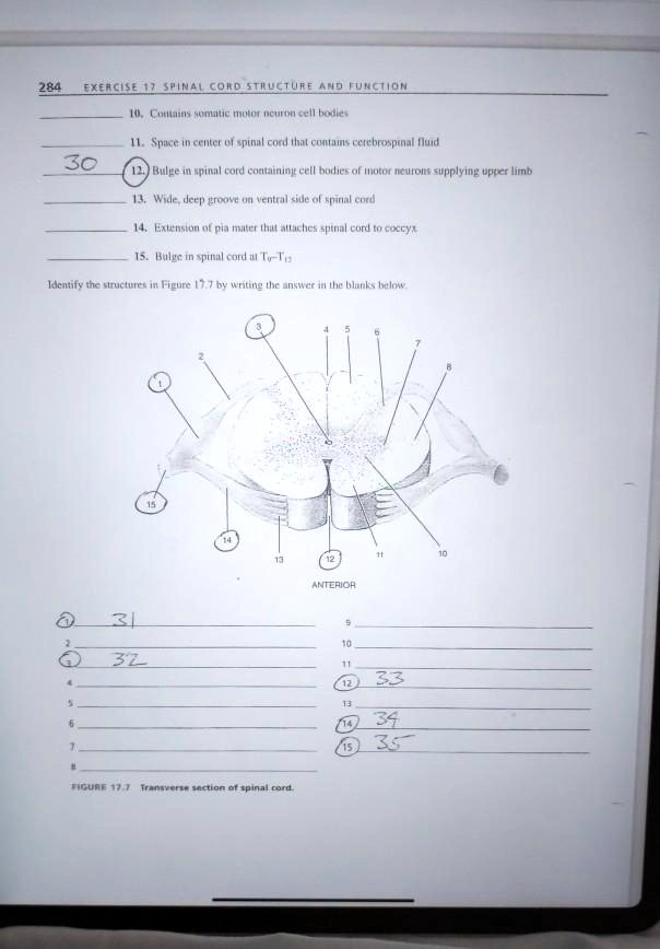 284 EXERCISE 17 SPINAL CORD STRUCTURE AND FUNCTION 10. Contains somatic ...
