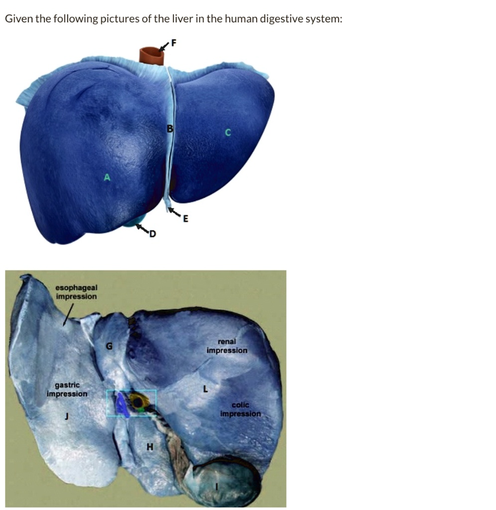 SOLVED: Match the letter with the term: Terms: - Falciform ligament ...