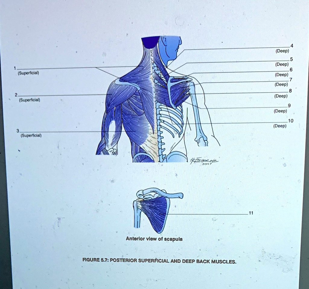 SOLVED: (Deep) (Deep) (Superficial) (Deep) (Deep) (Deep) (Superficial ...