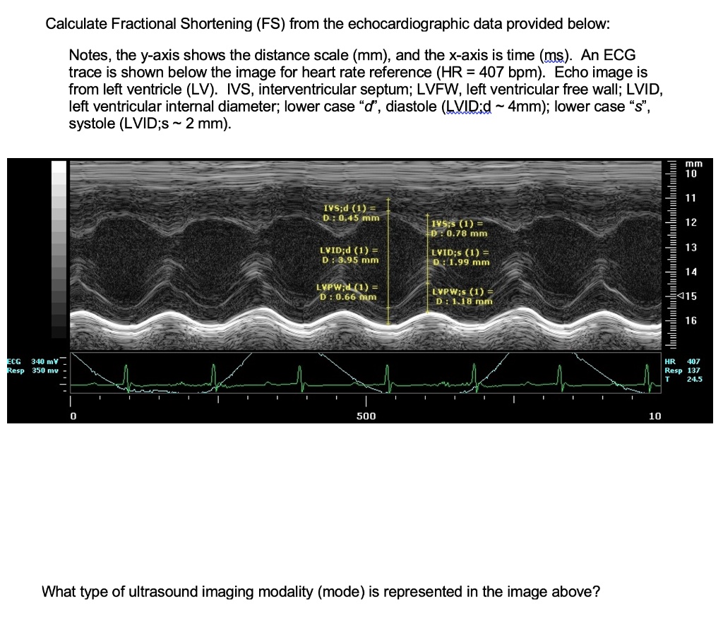Calculate Fractional Shortening (FS) from the echocardiographic data ...
